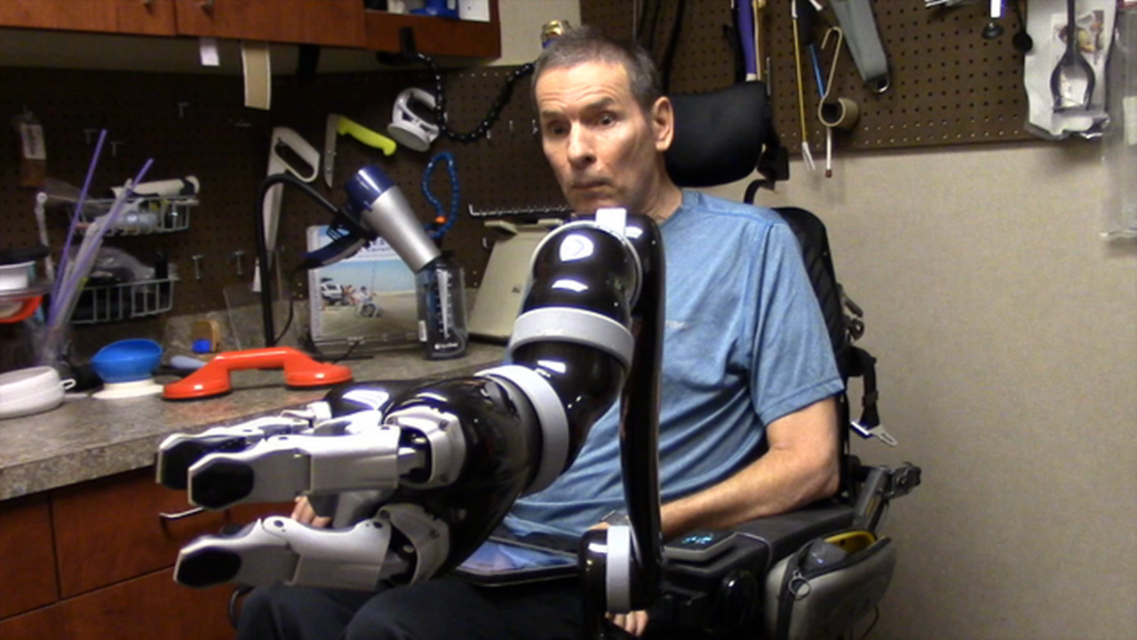 New high-tech robotic arm in action | Charlotte Observer