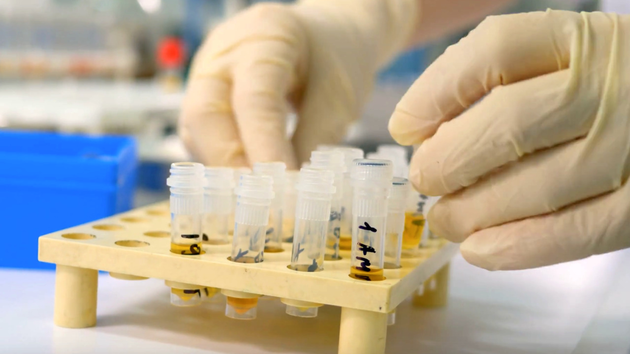 CA bill bars DNA test companies from secretly sharing data | Sacramento Bee