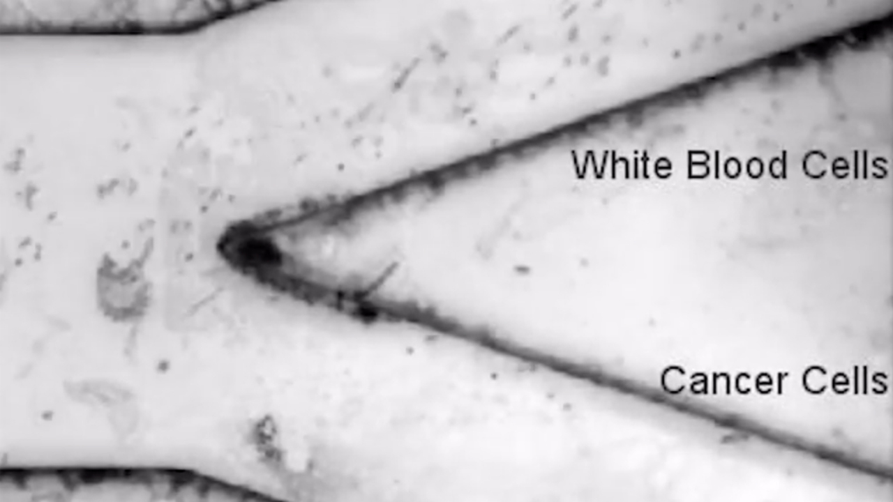 Cancer tumor cells: Duke researchers unveil prototype device | Durham ...